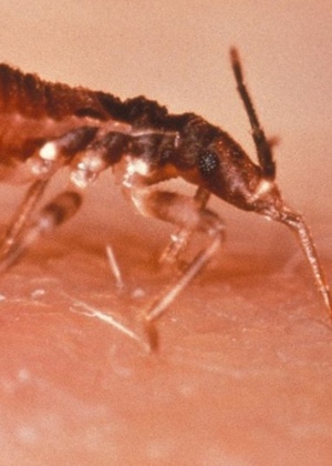 Estudo causa polêmica ao comparar Doença de Chagas à Aids - 31/05/2012 ...