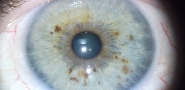 Fotos: Para a iridologia, as íris revelam as características emocionais ...