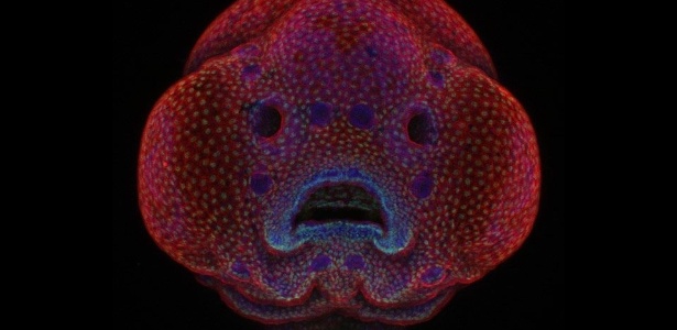 Concurso escolhe as melhores fotos do mundo microscópico - Notícias - BOL