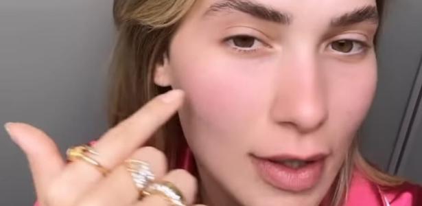 Qual a relação entre estresse e rosácea, que afeta Virginia Fonseca ...