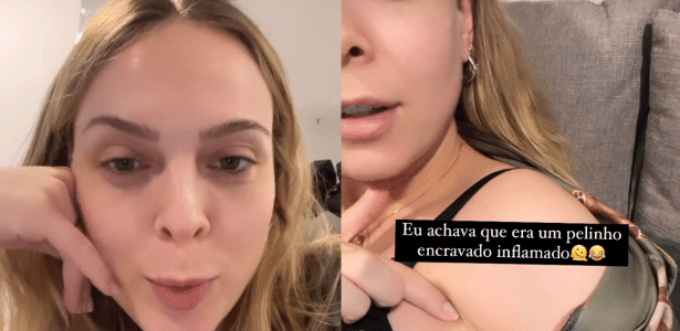 Tatá Estaniecki descobre que tem 'terceiro mamilo'; o que é polimastia? - 25/05/2023 - UOL VivaBem