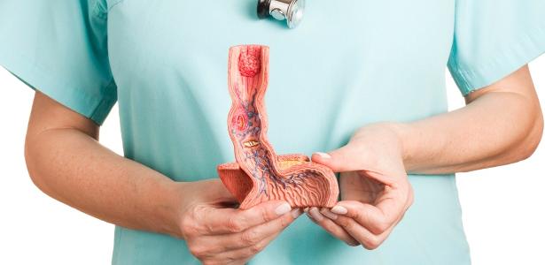 Câncer de esôfago: o que é, causas, tratamentos e cuidados