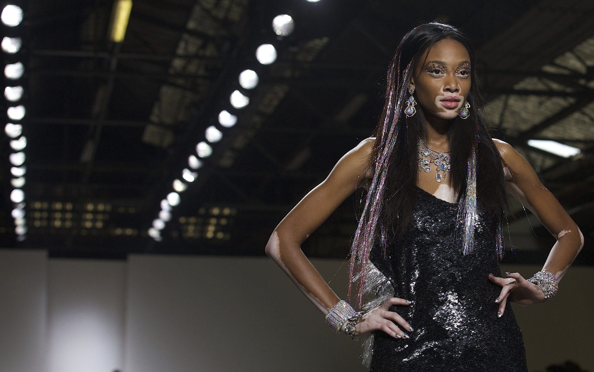 Top com vitiligo posta nude e dá recado: "celebre sua beleza única ...