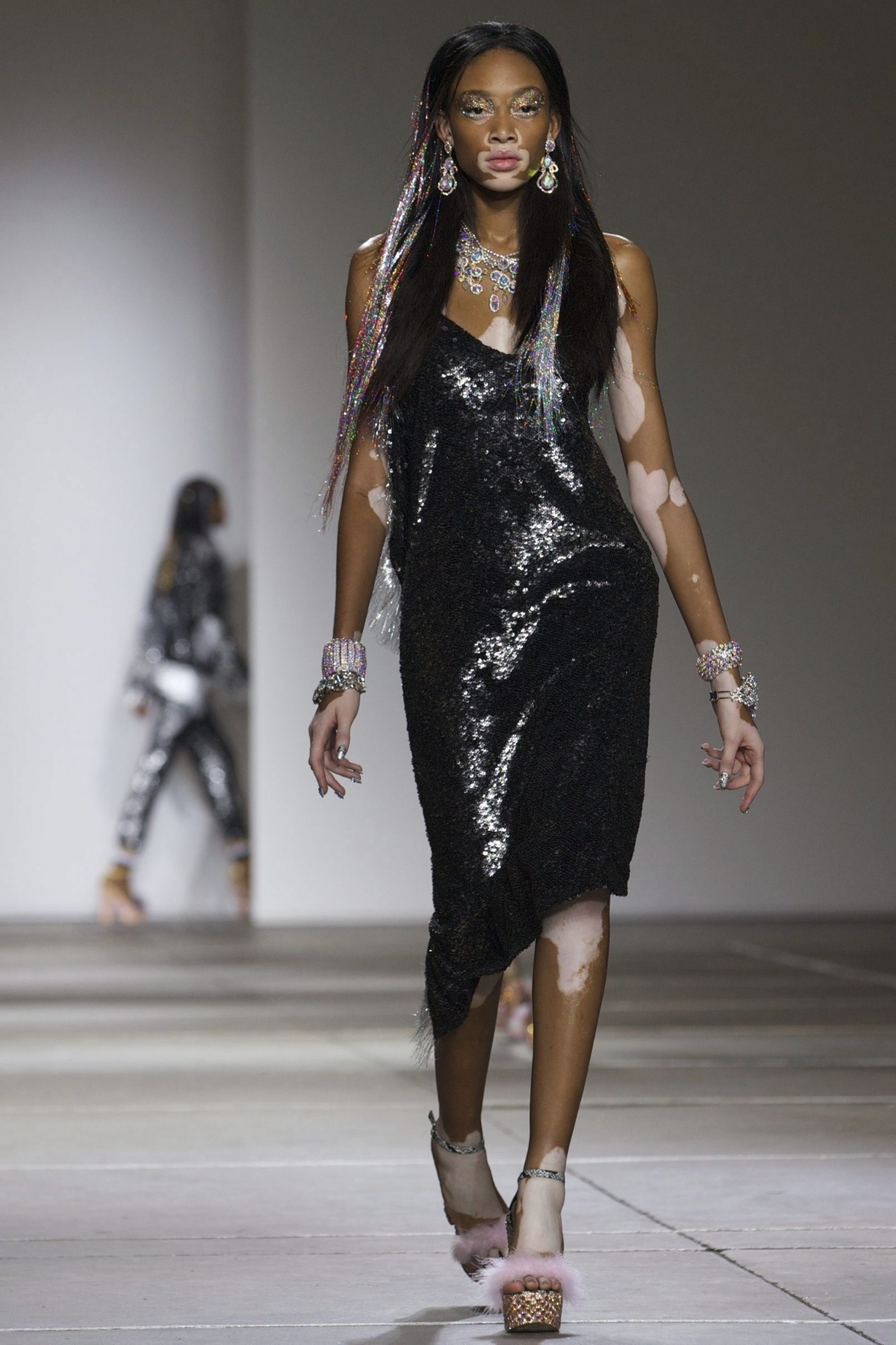 Top com vitiligo posta nude e dá recado: "celebre sua beleza única ...