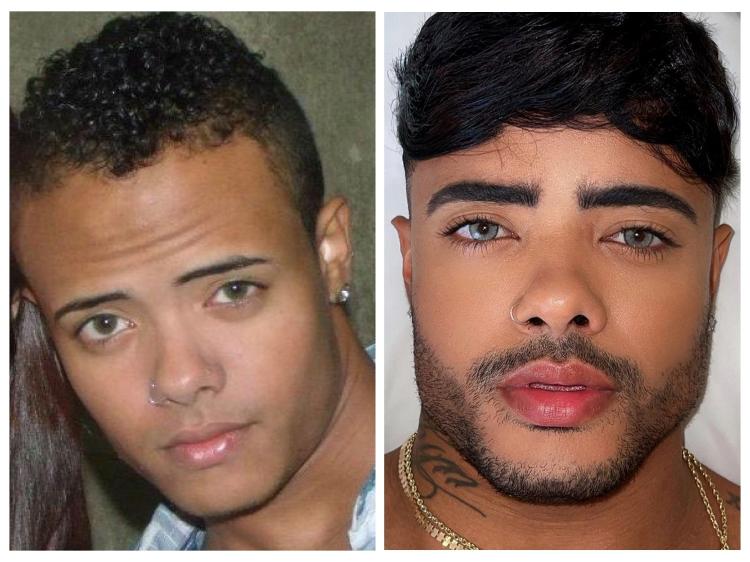 Selfies aumentam busca por plástica: 'Quero me encaixar nos padrões ...