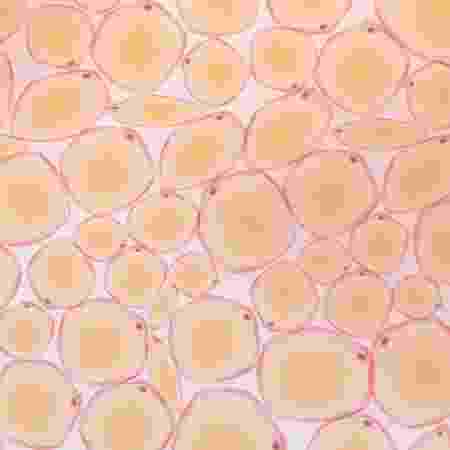 Brasileiro descobre em gordura do corpo caminho para tratar diabetes ...