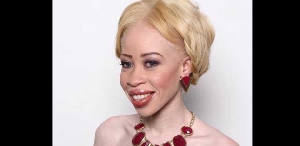 Conheça Refilwe Modiselle, a primeira modelo albina da África do Sul ...