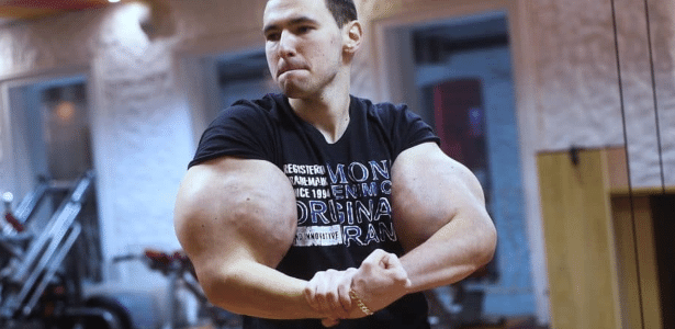 Russian Popeye risks arm amputation after injecting oil into biceps ...