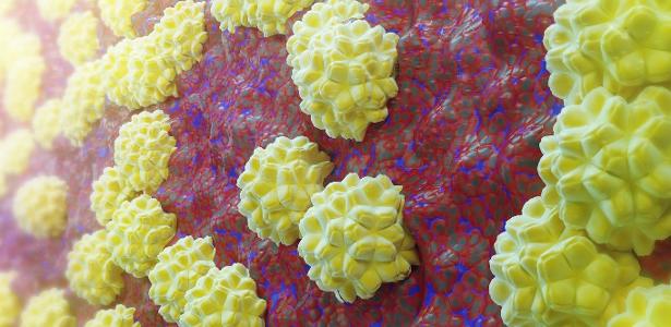 Clamídia é uma IST que se esconde do sistema imune e dos gestores de ...