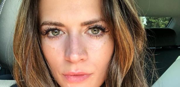 Modelo compete em reality escondendo vitiligo: "deixei aquilo me ...