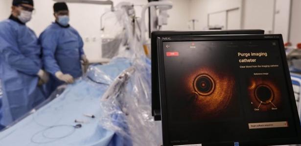 InCor usa inteligência artificial para desobstruir artéria do coração ...