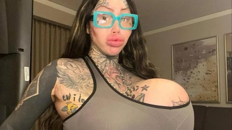 Implante de influencer viciada em plásticas explode