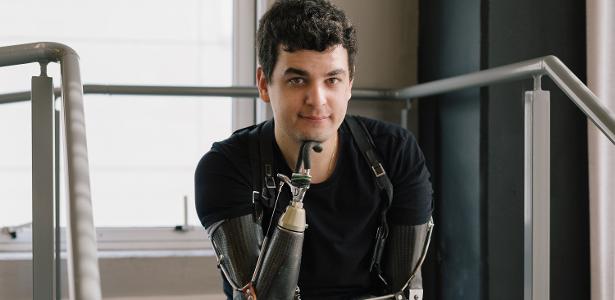 Pedro Pimenta criou modelo de negócio para atender pessoas amputadas