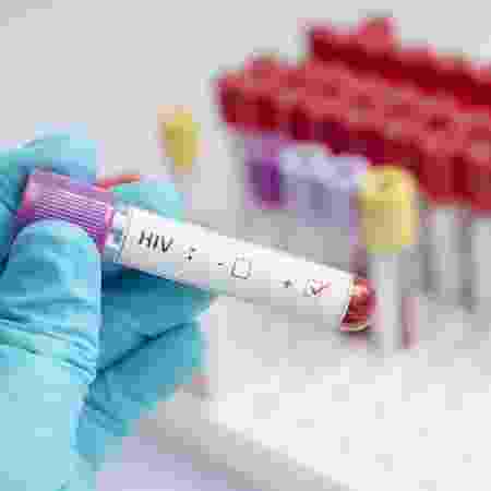 ONU: cerca de 1,7 milhão de pessoas foram infectadas pelo HIV em 2018 ...
