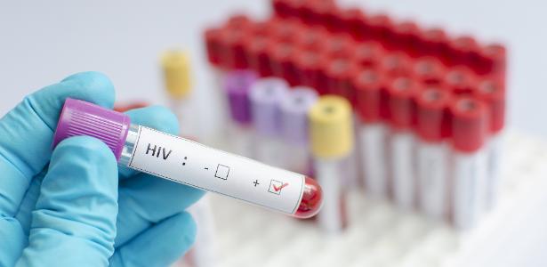Histórias reais ilustram a evolução no tratamento da Aids - 30/11/2019 ...