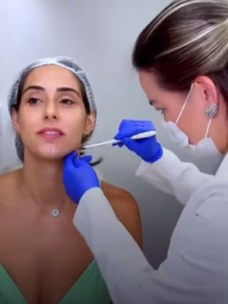 BBB 24: quais procedimentos estéticos os eliminados já fizeram?