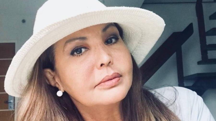 Simbolo sexual dos anos 80, Roberta Close faz harmonização facial