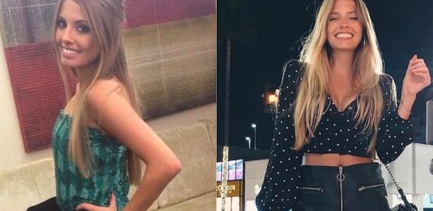 Apresentadora da Globo lembra acidente no qual perdeu perna há 9 anos