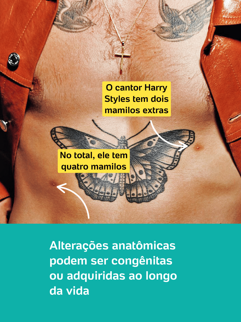 Terceiro mamilo: por que algumas pessoas têm?