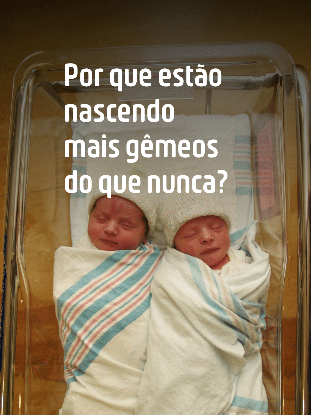 Por que estão nascendo mais gêmeos do que nunca?