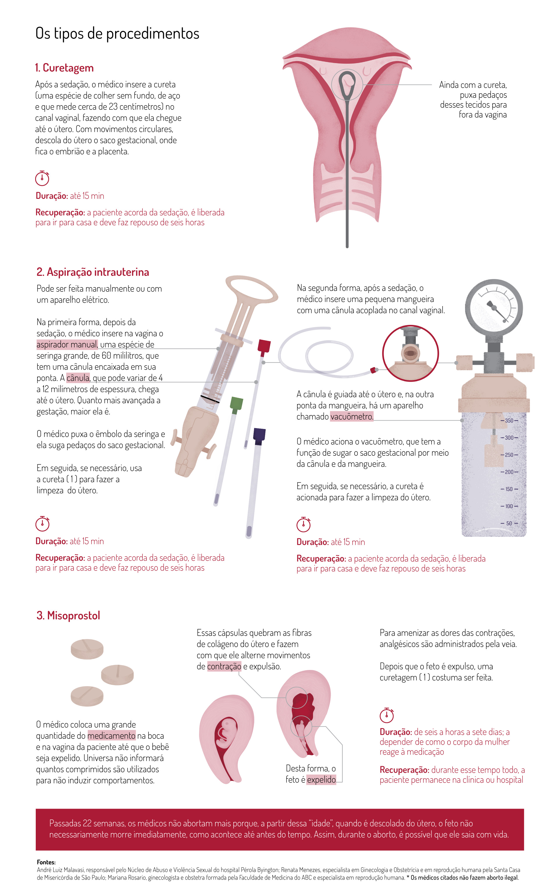 Como é feito um aborto?