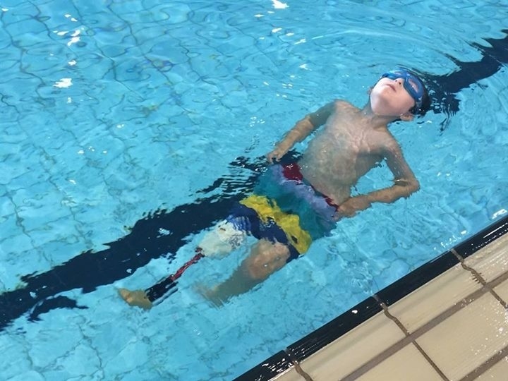 Fotos: Rio Woolf, garotinho que sonha em ser para-atleta - 25/02/2015 ...