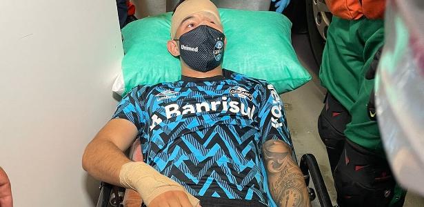 Gre-Nal: Federação remarca partida após ataque a ônibus do Grêmio