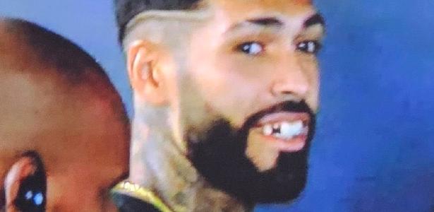 Barboza, do Botafogo, perde dente durante briga em jogo com Flamengo