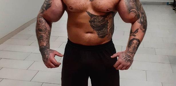 Dono de 'maior bíceps do mundo' revela imagem após cirurgia