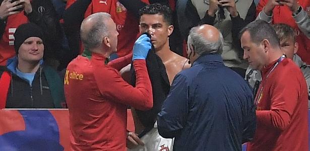 Cristiano Ronaldo treina com olho roxo e corte no rosto; veja