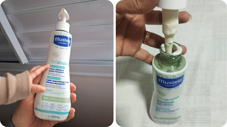 Hidratante Mustela promete reduzir coceira de dermatite em bebês