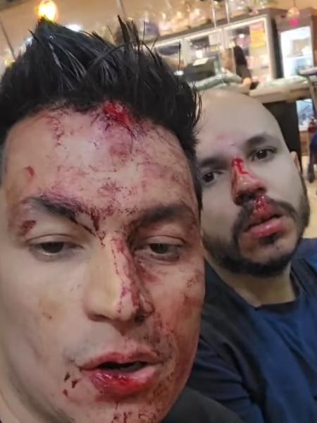 Eleito em Guarulhos, Sanches é acusado de mandar agredir ex-assessor