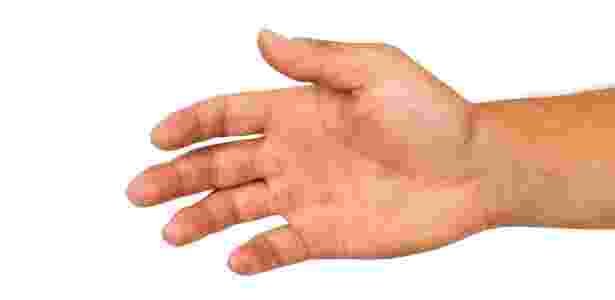 Como se formam os calos? A hora em que você compra sapato pode ...