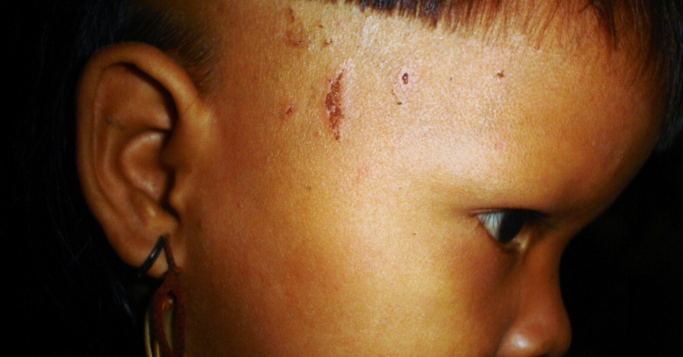 Indígenas sofrem 'mordidas' de baratas após infestação em aldeias - BOL ...