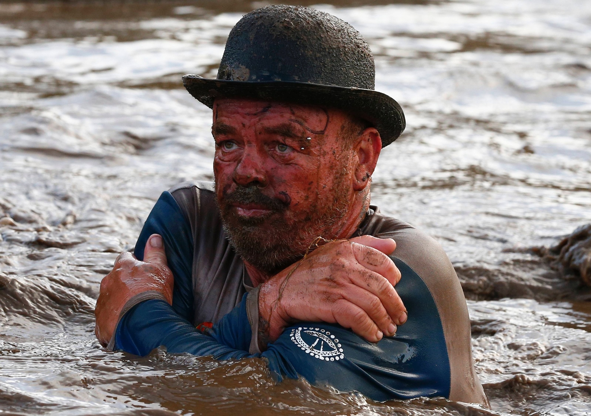 Ferido após luta com tubarão, médico vai pro bar antes de ir pro ...