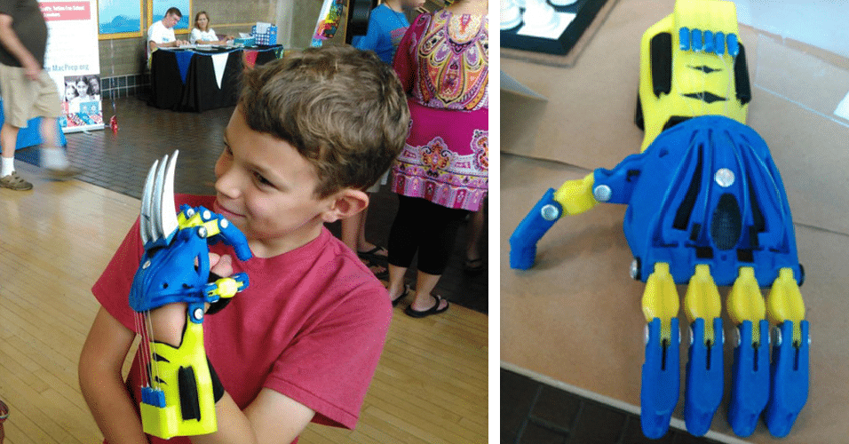 Peças feitas em impressora 3D prometem mudar vidas; conheça - BOL Fotos ...