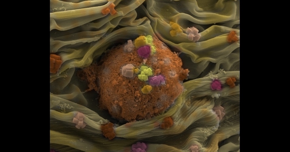 Fotos microscópicas revelam detalhes incríveis - Fotos - Ciência
