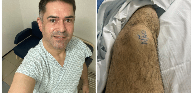 Paciente marca joelho a ser operado para evitar erro em cirurgia no CE