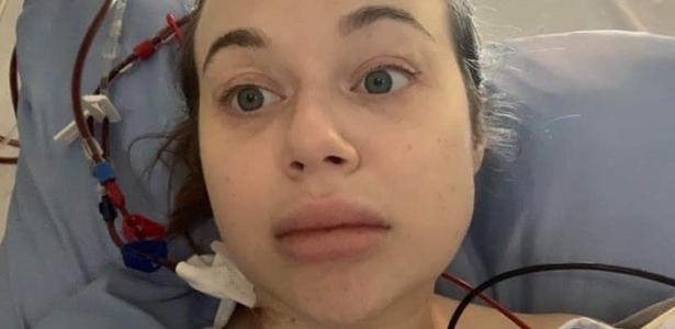 Mulher 'desmaia' de bêbada e quase perde perna por falta de circulação