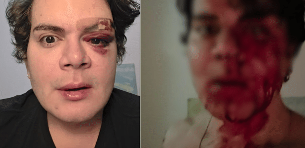 Médico é espancado por vizinho