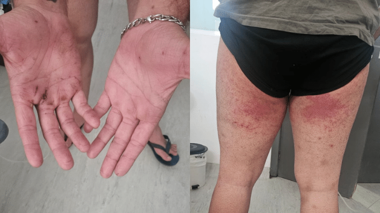 Irmã mostra como ficou o corpo de jovem que se perdeu em trilha no Paraná