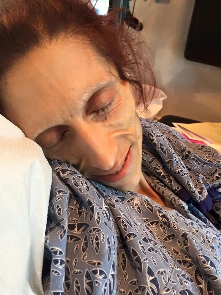 Atriz americana com anorexia dá primeiros passos após conseguir ...