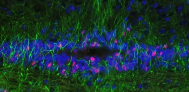 Lagartixas podem indicar caminho para tratamento de lesões na medula ...