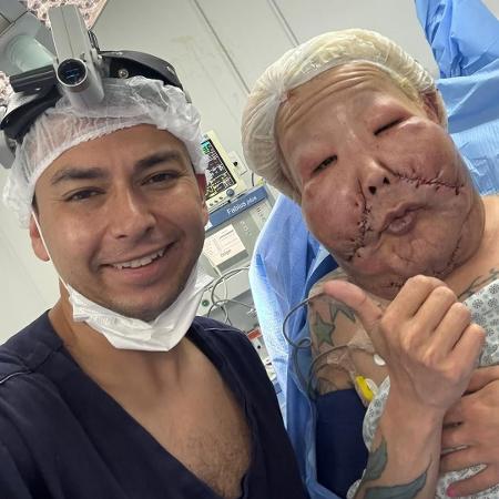 Juju do Pix revela o rosto após cirurgia para remover óleo mineral