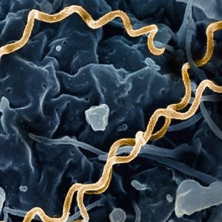 Pesquisa encontra vestígio de que sífilis já estava no Brasil há 2.000 anos