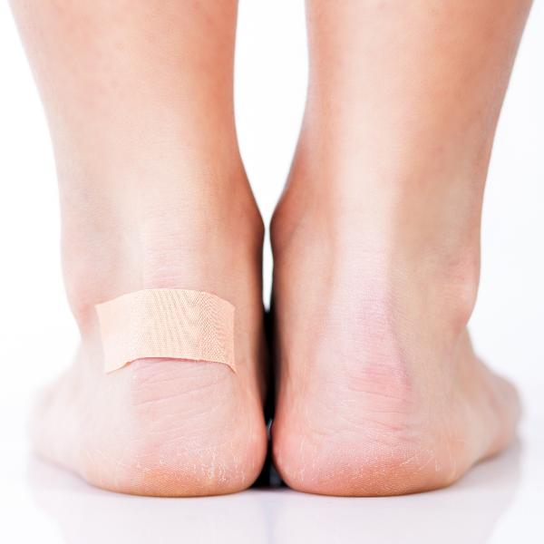 Calos e calosidades: Saiba como prevenir e tratar | UOL VivaBem