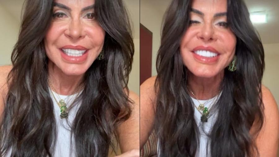 Gretchen: Cantora explica novo processo de harmonização facial