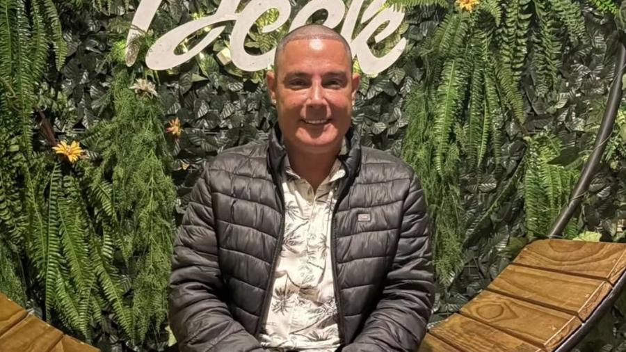 Vavá faz transplante capilar após harmonização facial