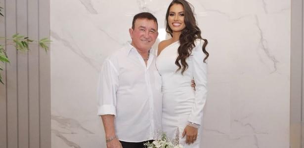 Amado Batista se submete a transplante capilar; veja resultado