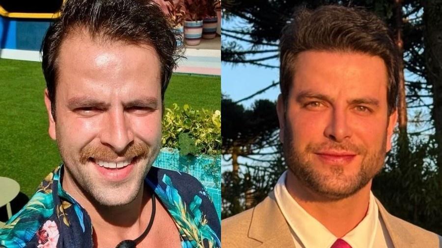 Gustavo Marsengo: como ficou ex-BBB após harmonização facial?
